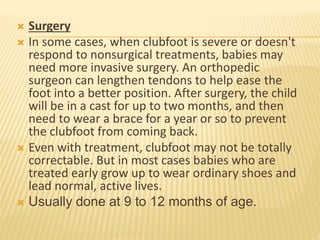 Club foot | PPTX