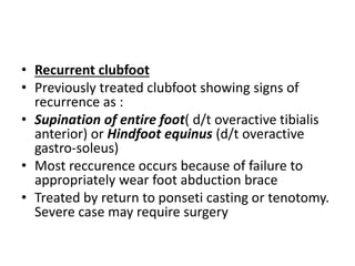 Club foot | PPTX