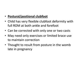 Club foot | PPTX