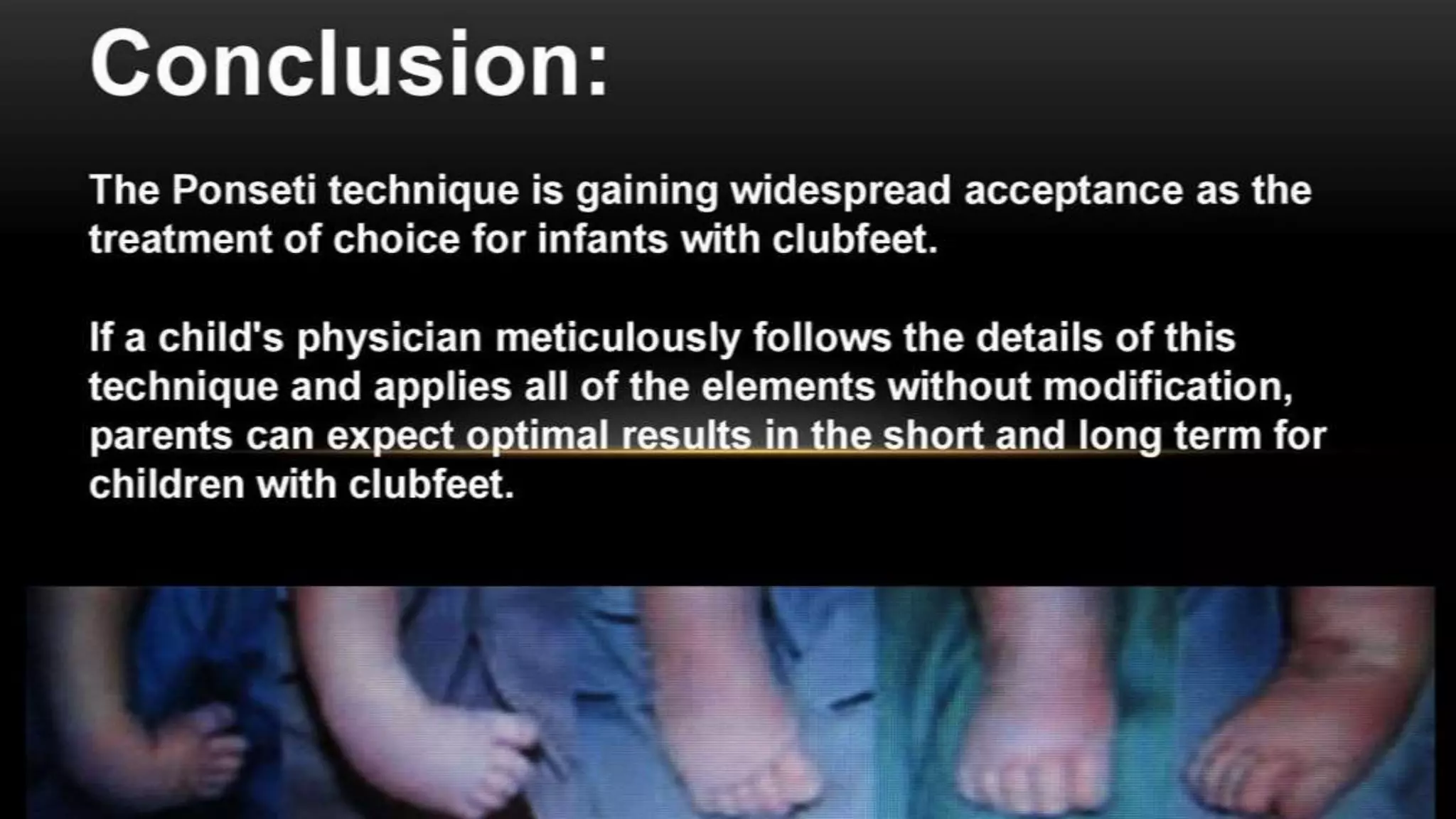 Clubfoot | PPTX