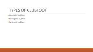 Clubfoot | PPTX