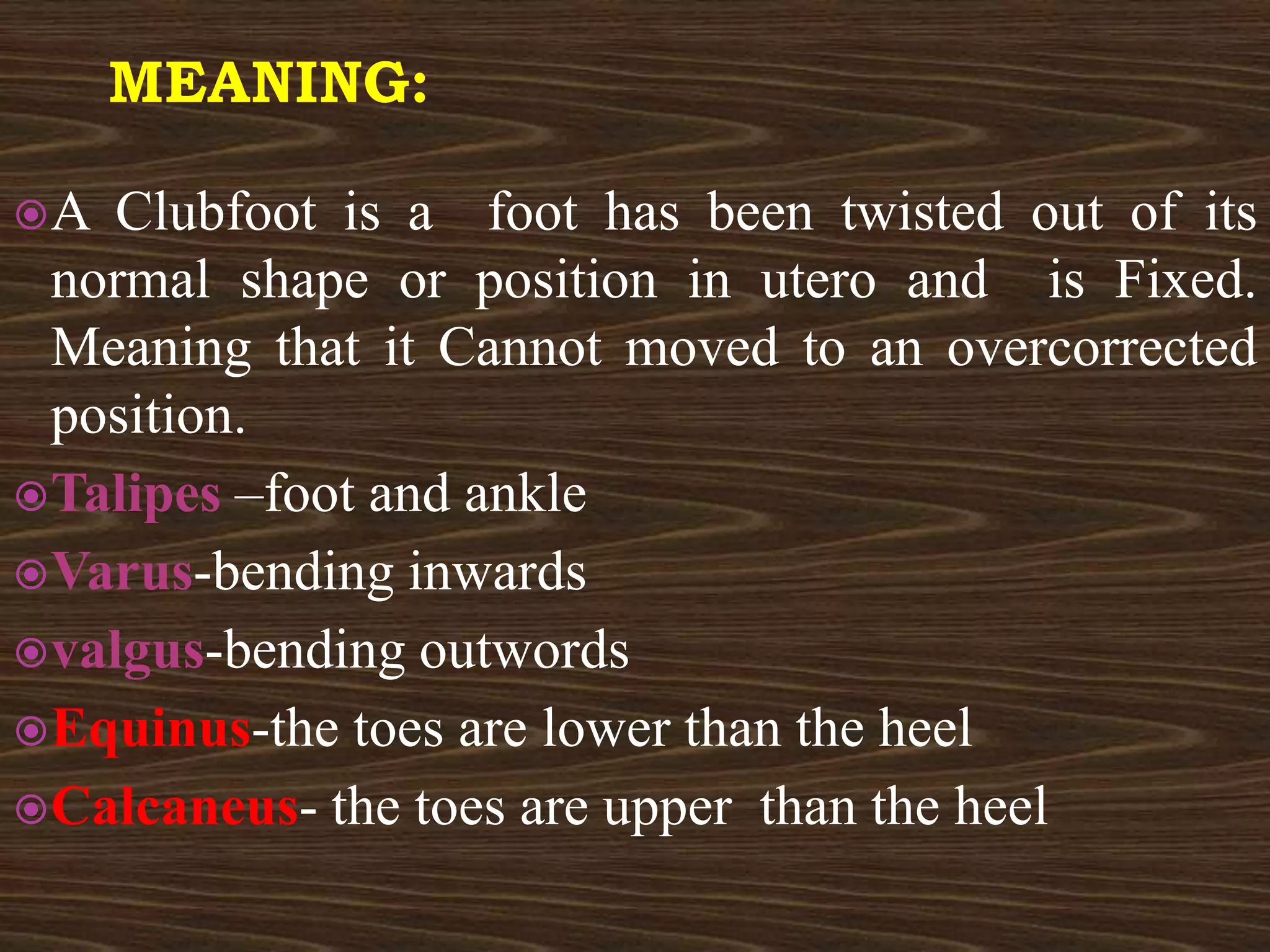 Club foot | PPT