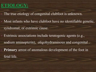Club foot | PPT
