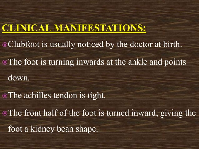 Club foot | PPT | Foot Health | Diseases and Conditions