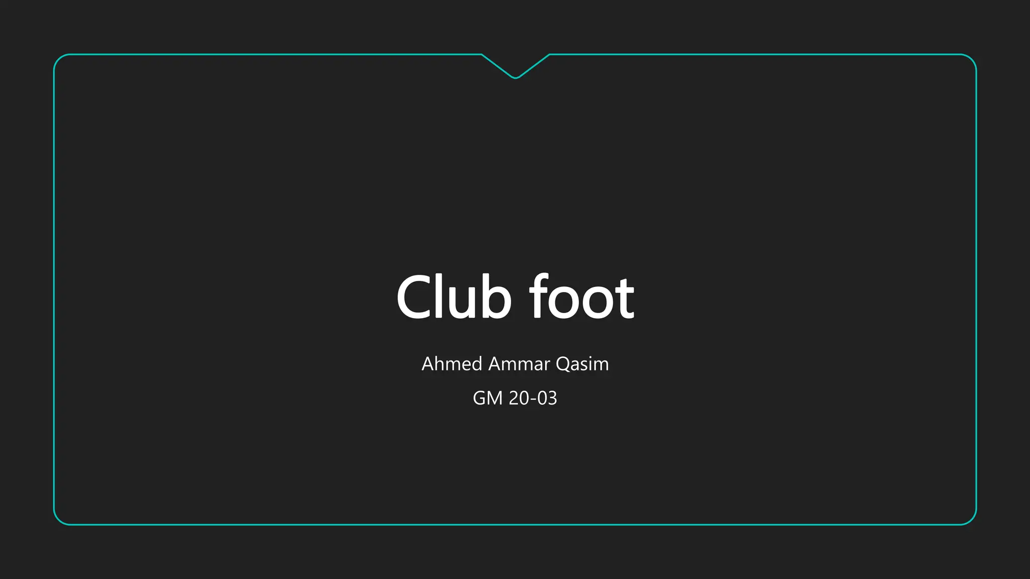 Club foot detailed lecture power point.pptx