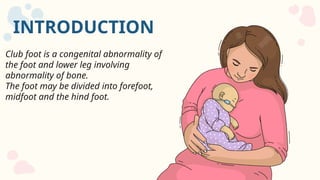 club foot in children .pptx