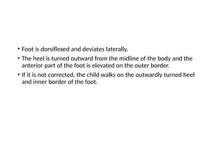 club foot in children, by Dr. Sapna Singh, Professor, Teerthanker ...