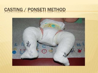 Clubfoot prof g s patnaik | PPTX