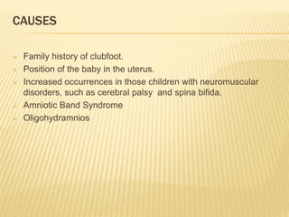 Clubfoot prof g s patnaik | PPTX
