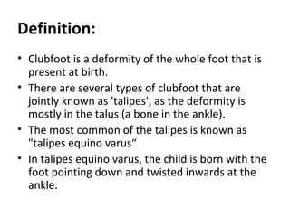 Club foot[1] | PPT