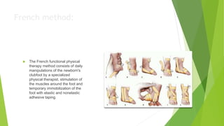 CLUB FOOT 1.pptx | Death, Injury, or Military Conflict | Sensitive Topics