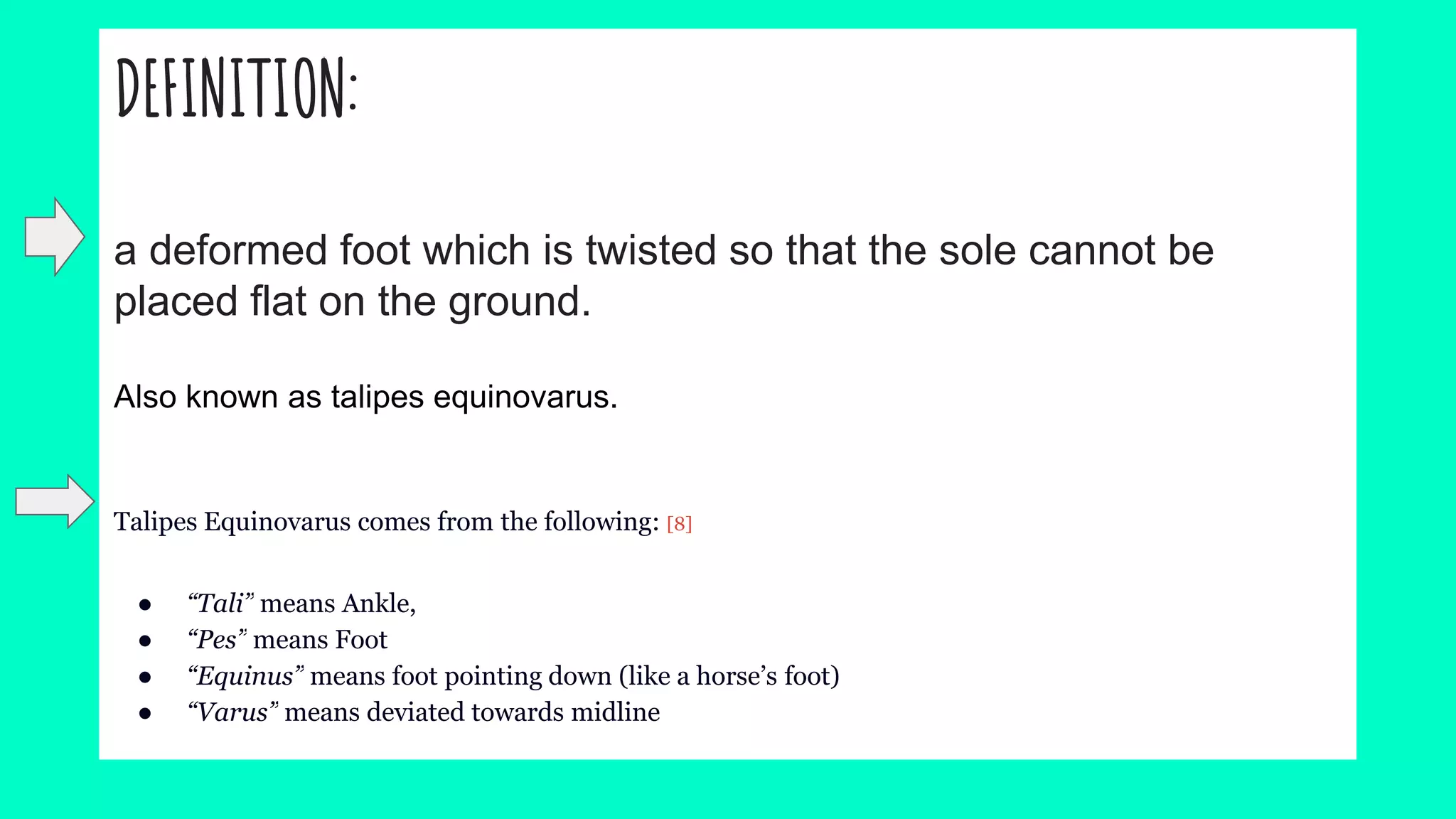 Club foot ppt | PPTX