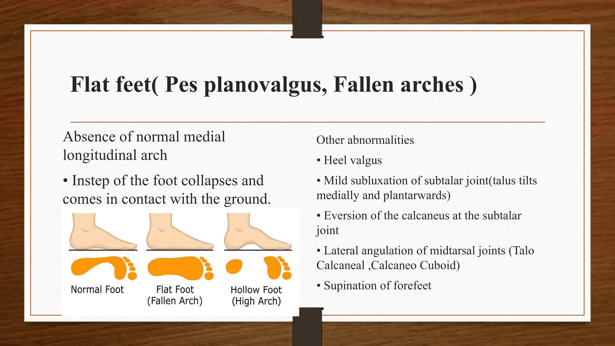 CLUB FOOT (2).pptxnnnnnnnnnnnnnnnnnnnnnnnn | PPTX