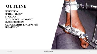 Club foot SHAKER BARKER | PPT