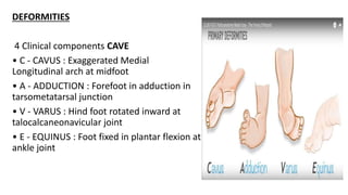 CTEV / Club foot by Dr Baijnath Agrahari | PPT