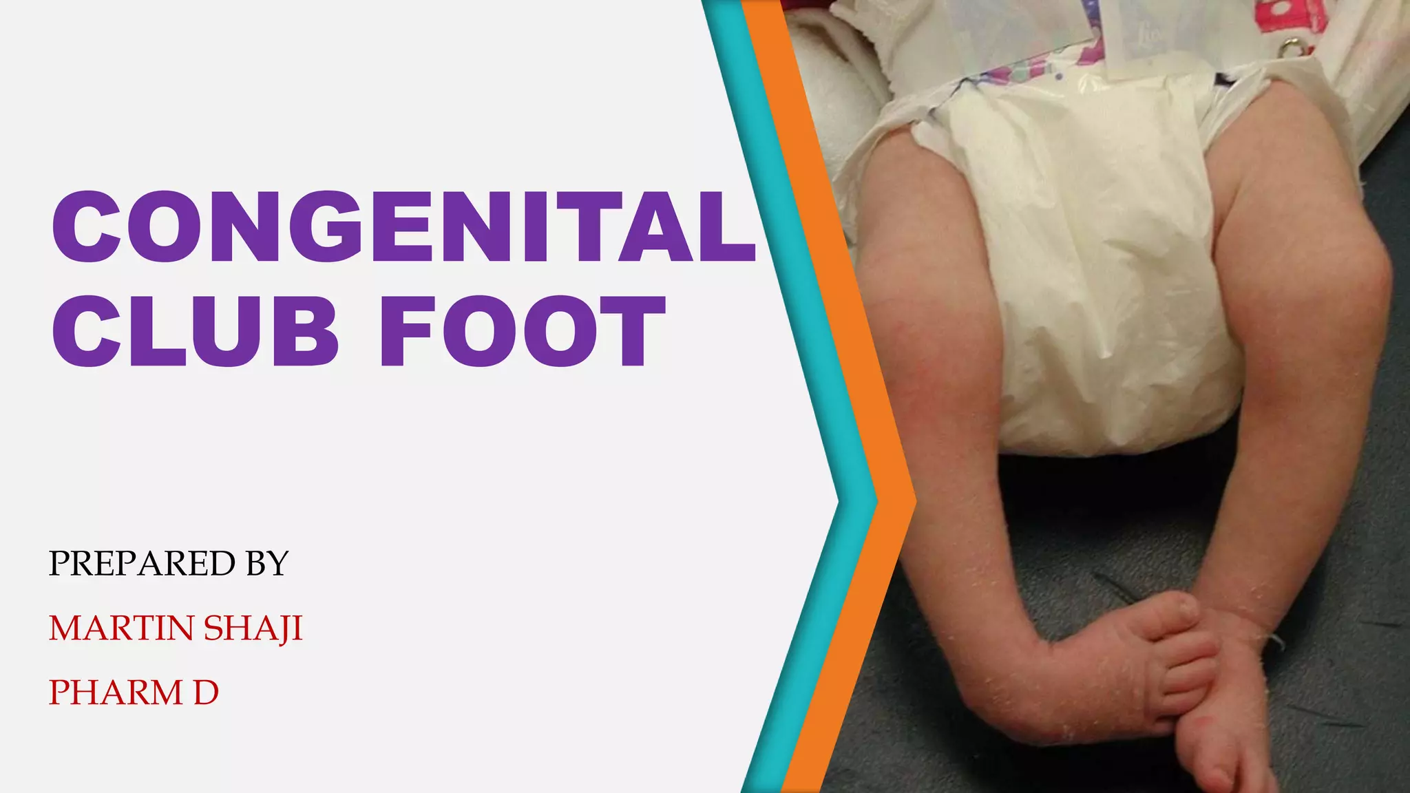 Congenital