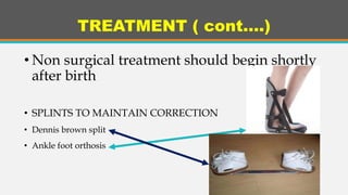 Congenital Club foot-Medical information | PPTX