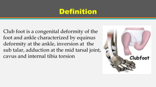 Congenital Club foot-Medical information | PPTX