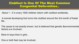 Congenital Club foot-Medical information | PPTX