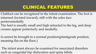 Congenital Club foot-Medical information | PPTX