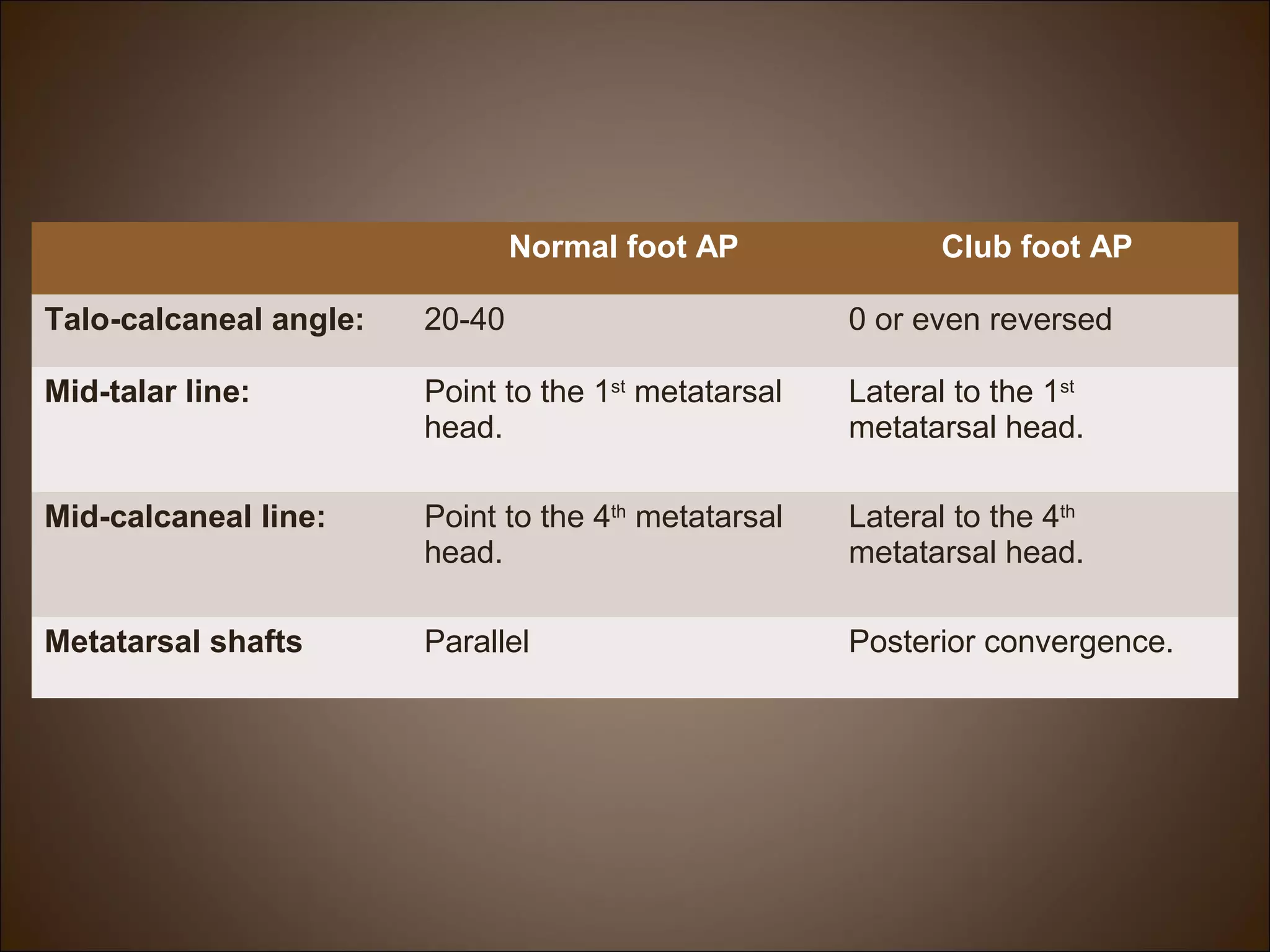 Club foot deformity | PPT