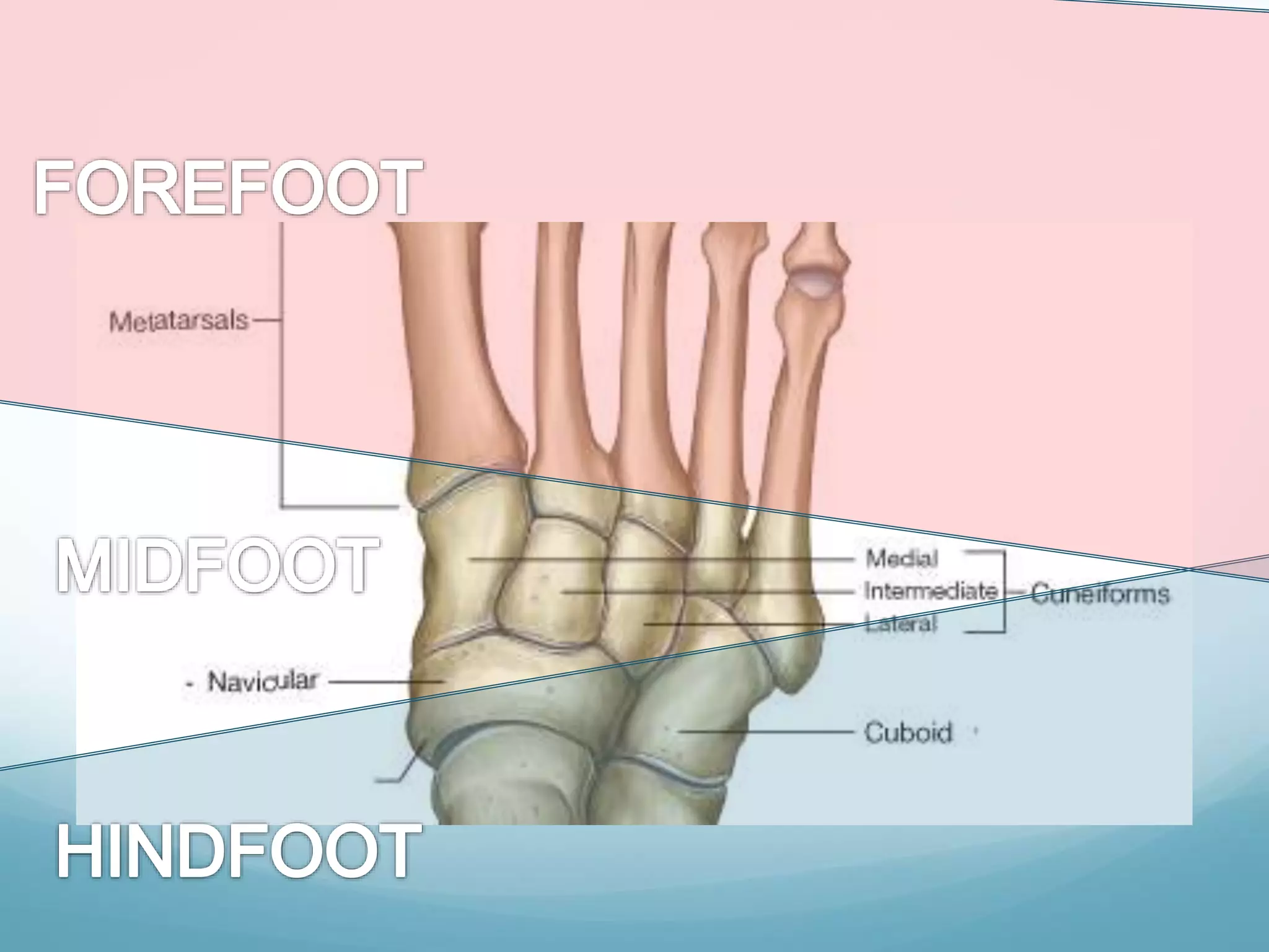 Clubfoot | PPTX