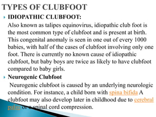 clubfoot ppt.pptx