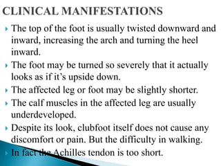 clubfoot ppt.pptx