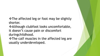 club foot ppt.pptx
