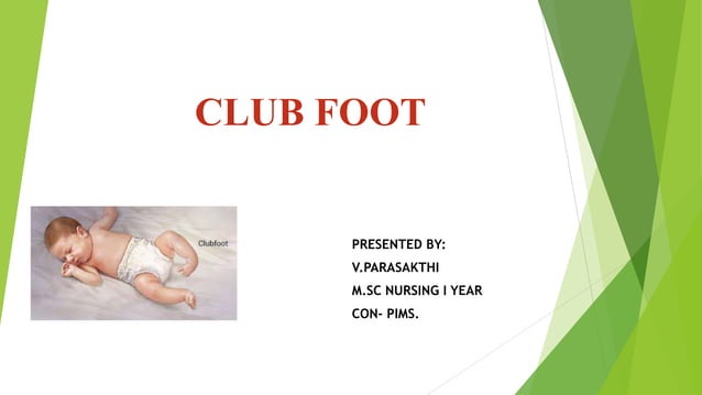 club foot ppt.pptx | Foot Health | Diseases and Conditions