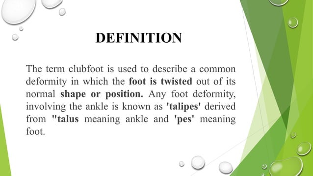 club foot ppt.pptx | Foot Health | Diseases and Conditions