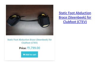 Clubfoot treatment at Kids Orthopedic, Kolkata | PDF