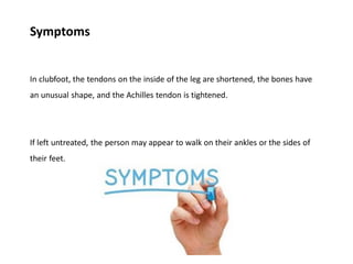 Clubfoot treatment at Kids Orthopedic, Kolkata | PDF