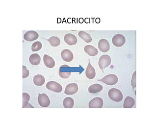 Células hematologicas | PPT