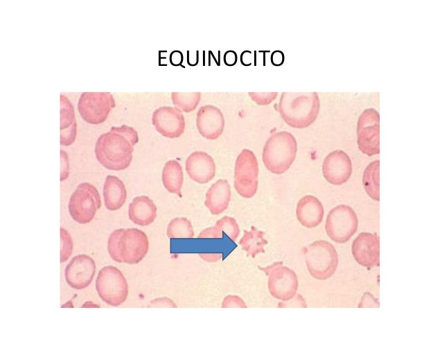 Células hematologicas