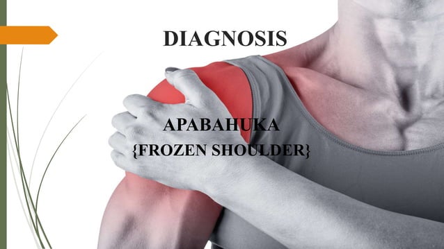 CASE PRESENTATION ON APABAHUKA (FROZEN SHOULDER) | PPTX