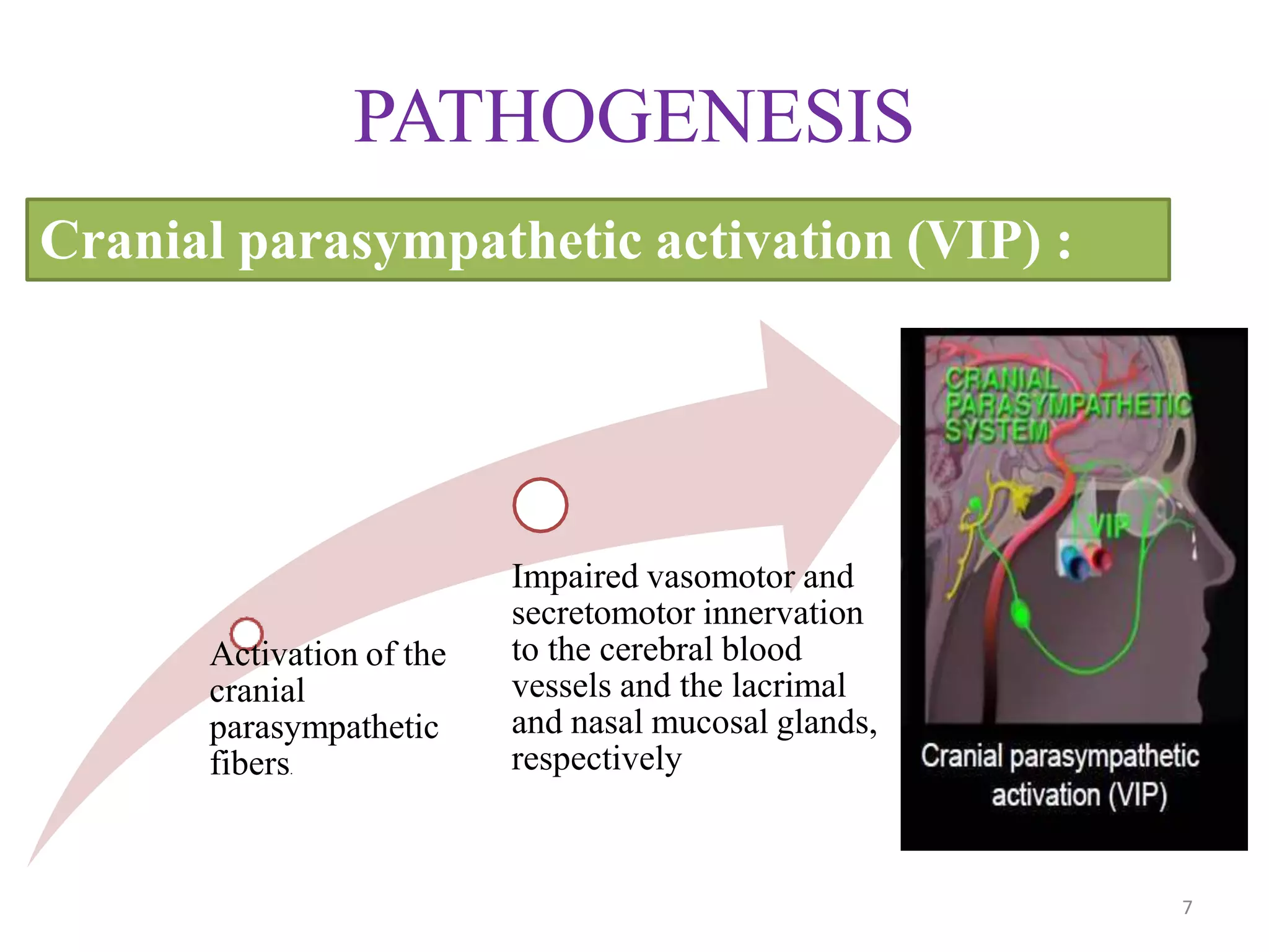 cluster headache.pptx