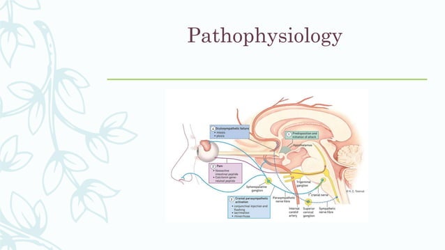 Cluster Headache | PPT