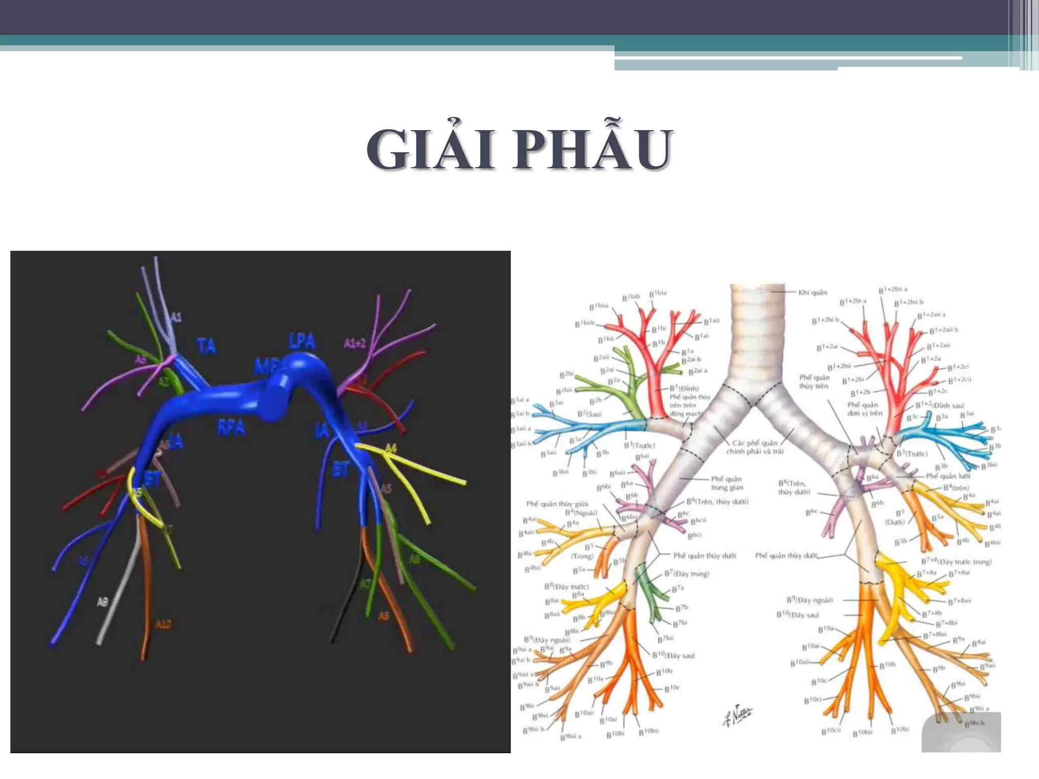 Radiologyhanoi.com CLVT mạch máu: Động mạch phổi | PPTX