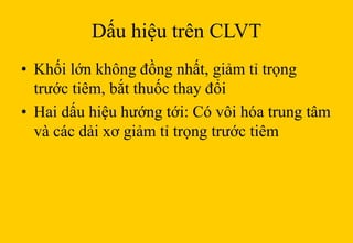 Clvt trong cđ u gan 2 | PPTX