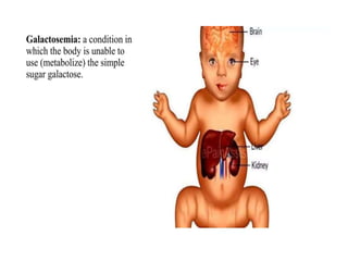 congenital Malformations-Neural tube defectsAnencephaly, | PPTX