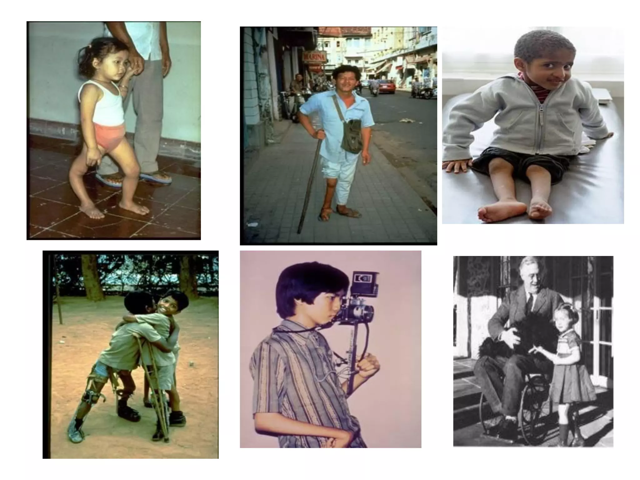 poliomyelitis 12 04-2016 | PDF