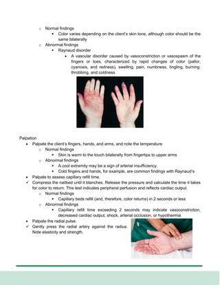 CM3 - CU13 ASSESSMENT OF PERIPHERAL VASCULAR SYSTEM.pdf