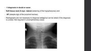 CM Acute Laryngeo-trachea Bronchitis.pptx