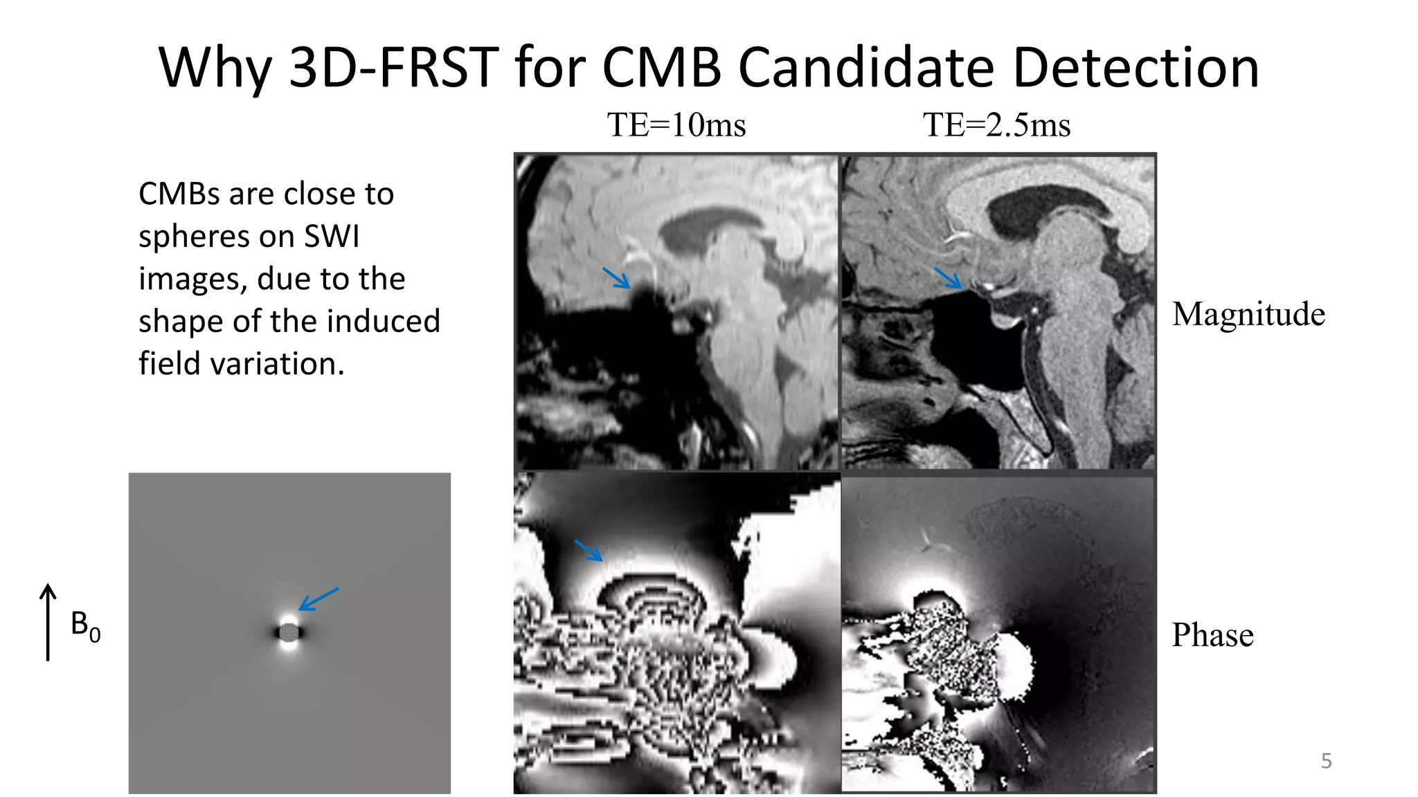 Cerebral Microbleed Detection Using Susceptibility Weighted Imaging And Deep Learning Ppt