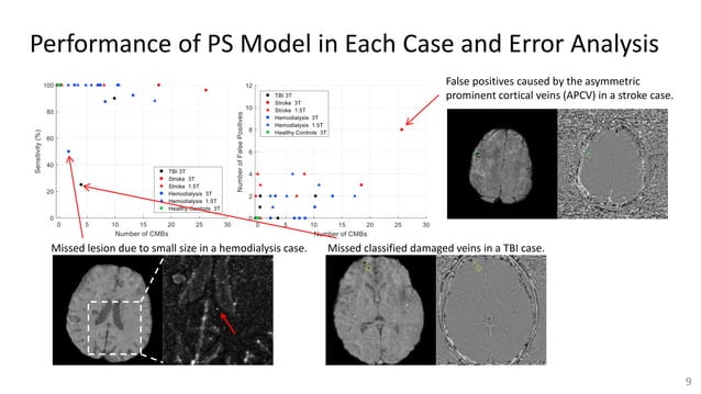 Cerebral Microbleed Detection Using Susceptibility Weighted Imaging And Deep Learning Ppt