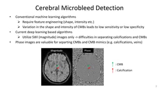 Cerebral Microbleed Detection using Susceptibility Weighted Imaging and ...