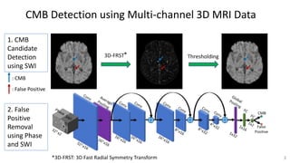 Cerebral Microbleed Detection using Susceptibility Weighted Imaging and ...