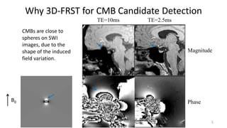 Cerebral Microbleed Detection using Susceptibility Weighted Imaging and ...