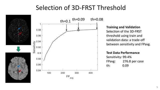 Cerebral Microbleed Detection using Susceptibility Weighted Imaging and ...